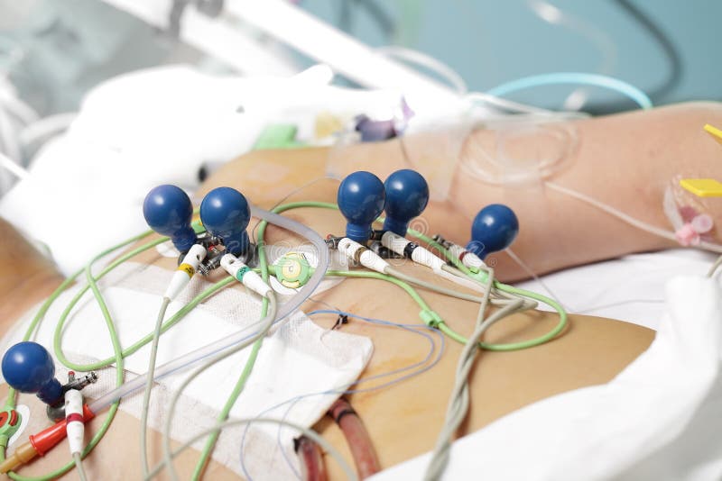 Patient in medical wires. stock photo. Image of intensive - 29512346
