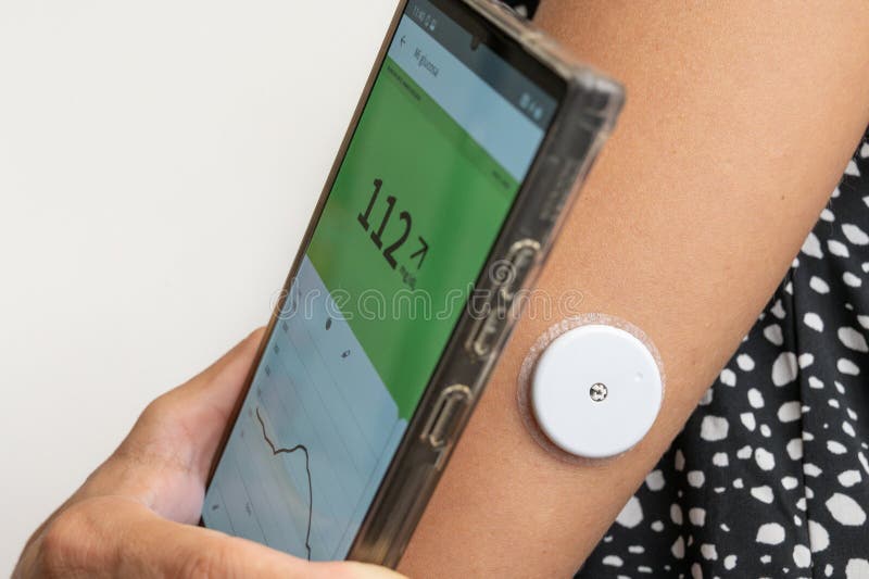 Patient Checking Glucose Level on Smartphone with Continuous Glucose ...