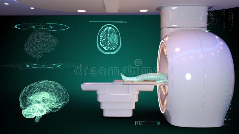 The Patient Moves in the MRI Scanner and an MRI of the Brain Appears on ...