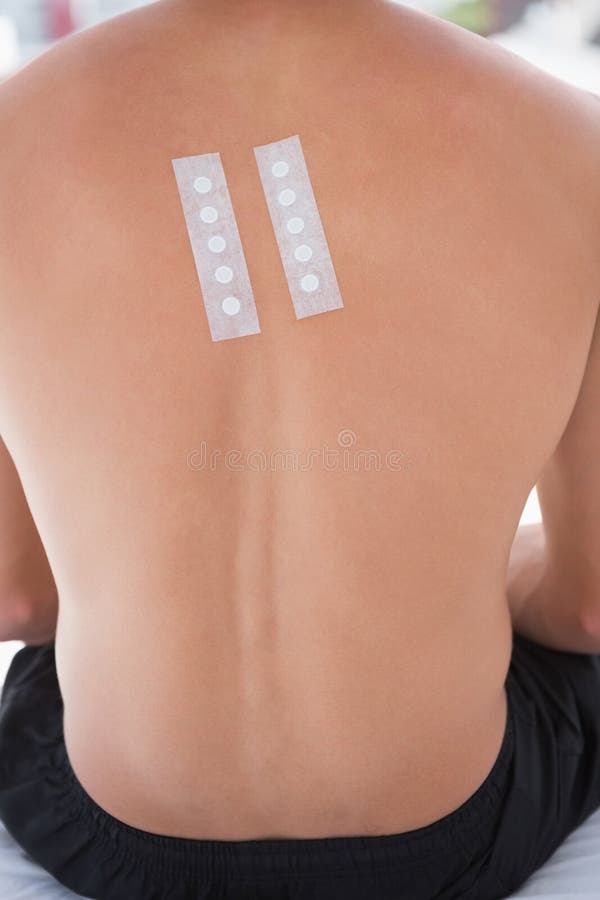 Patient Skin Test His Back Stock Photos - Free & Royalty-Free Stock ...