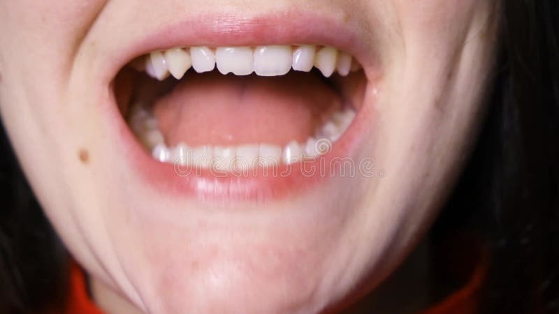 A Patient with Temporomandibular Joint Dysfunction Shows Malocclusion ...