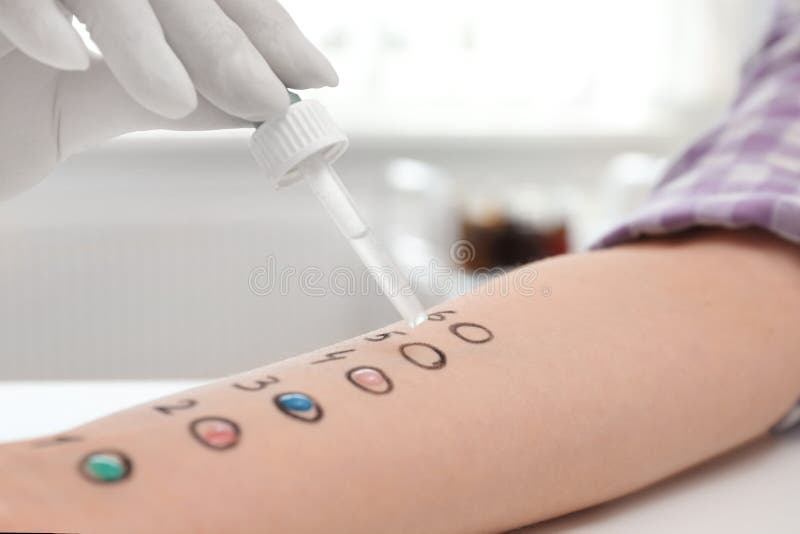 Patient Undergoing Skin Allergy Test at Light Table, Stock Image ...