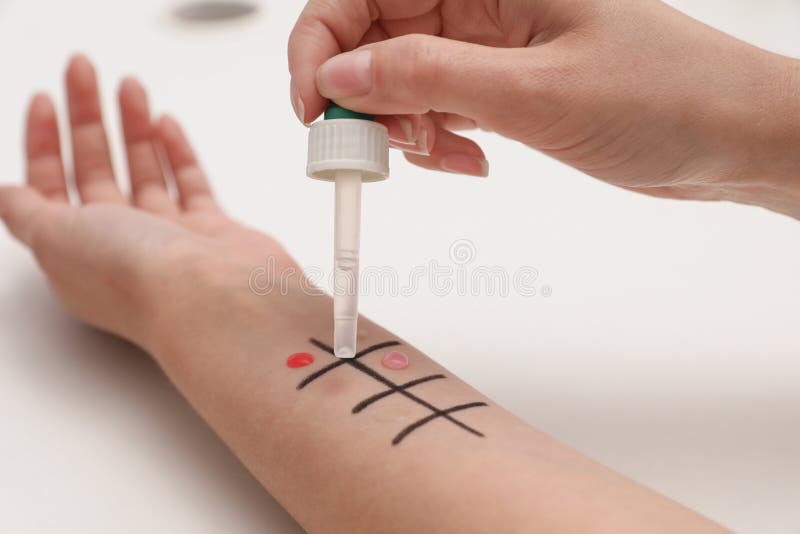 Patient Undergoing Skin Allergy Test at Light Table, Stock Photo ...