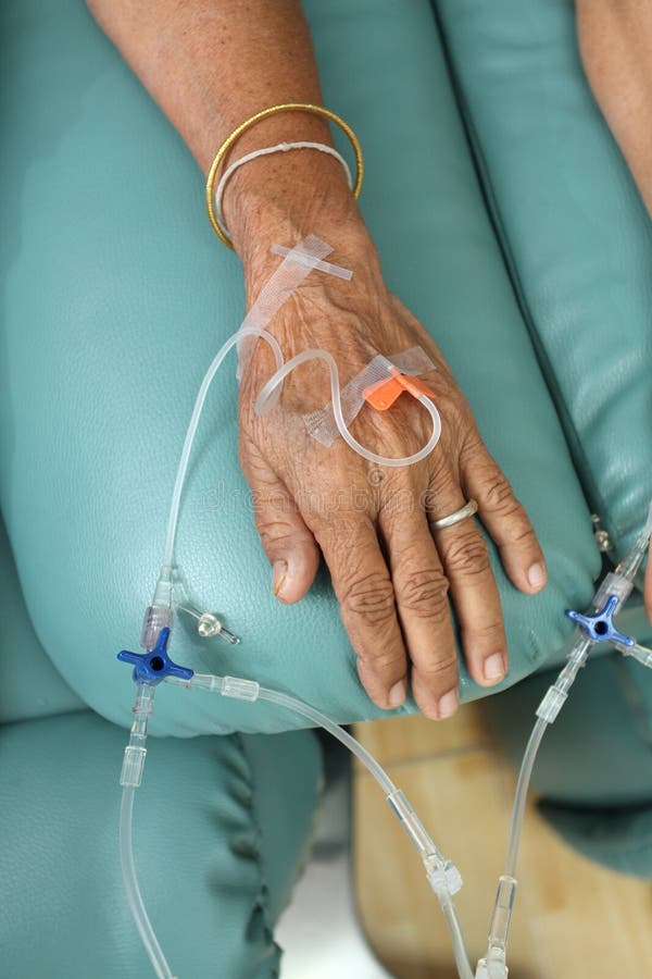 Patients Getting Intravenous Chemotherapy Stock Image - Image of health ...