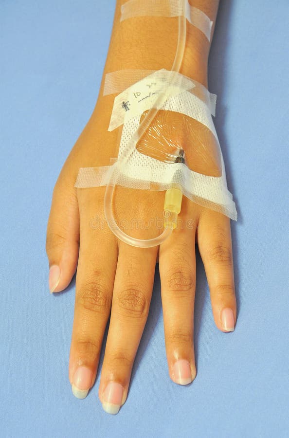 Hand of Sick Child, Intravenos Set Infusion. Stock Image - Image of ...