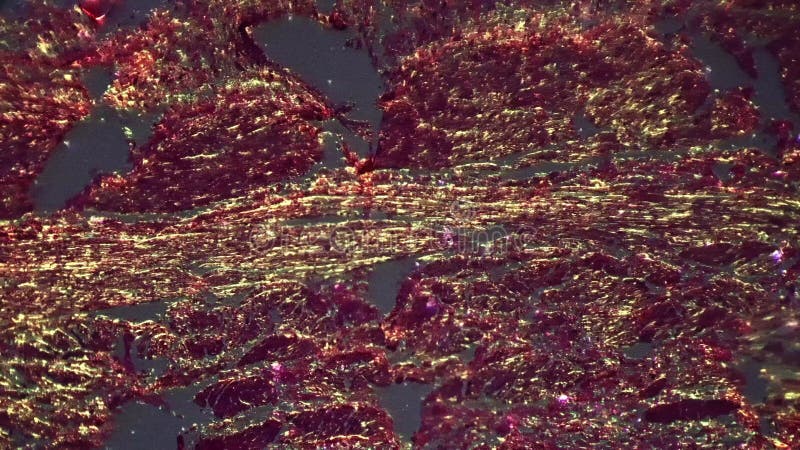 Pattern of Expand Human Bladder in Section Magnified with Microscope ...