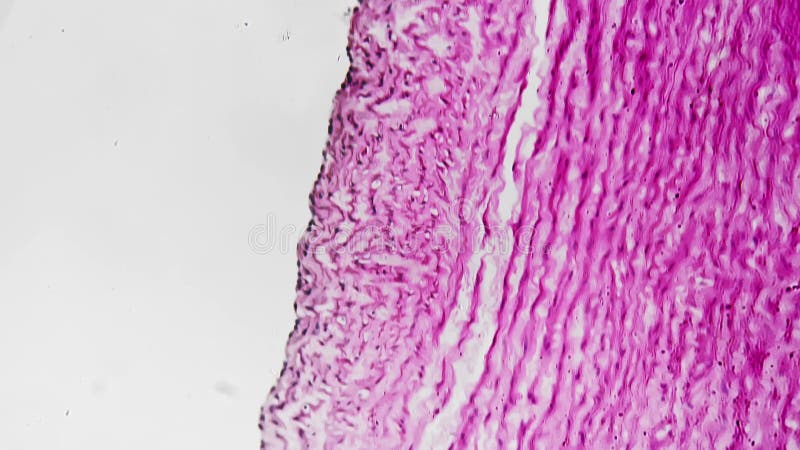 Pattern of Human Large Artery Taken for Experiment and Magnified Under ...