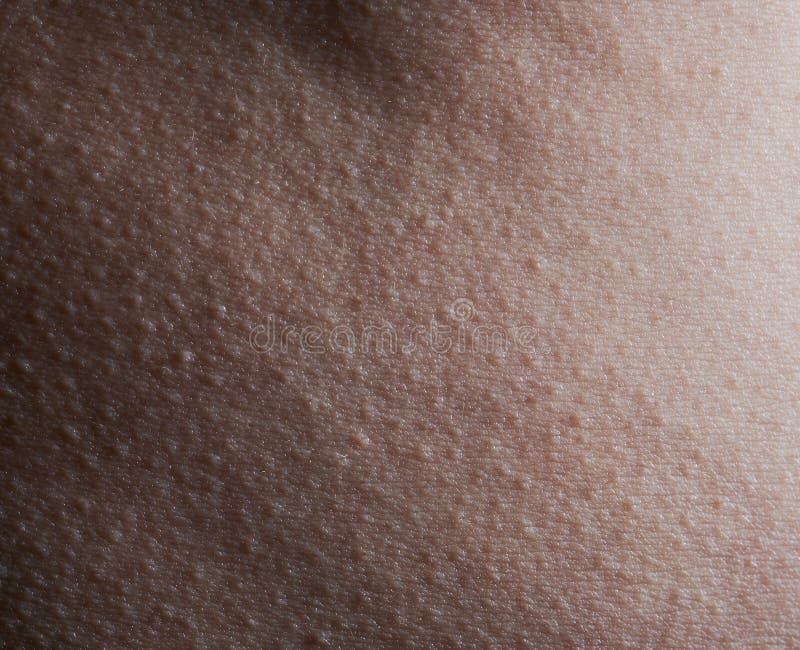 Pattern of Human Skin with Bumps Stock Image - Image of ectoderm, close ...