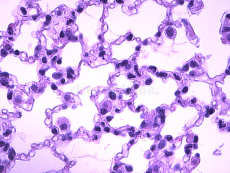 Lung Cells Under the Microscope Stock Photo - Image of illness, bionic ...