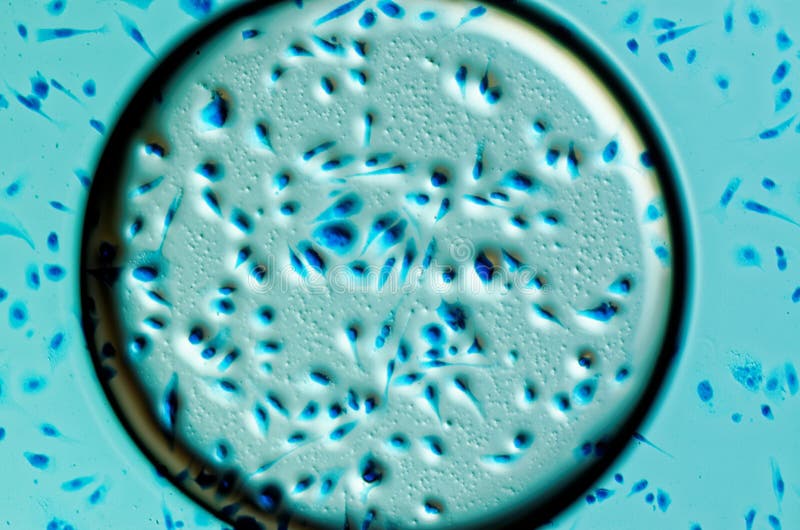 PC-3 Human Prostate Cancer Cells Stock Image - Image of health ...