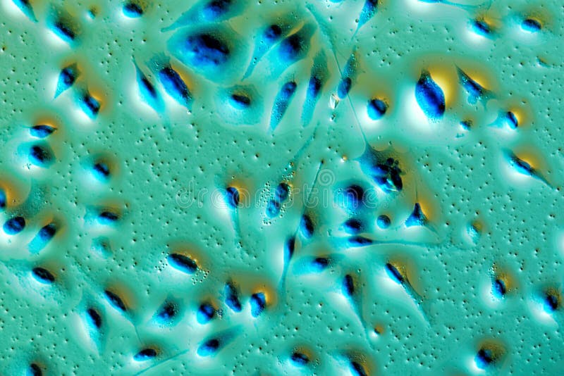 PC-3 Human Prostate Cancer Cells Stock Photo - Image of immortal ...