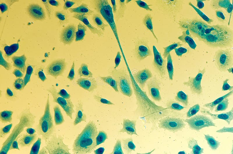 PC-3 Human Prostate Cancer Cells Stock Photo - Image of membrane, tumor ...