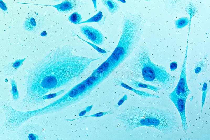 PC-3 Human Prostate Cancer Cells Stock Image - Image of animal ...