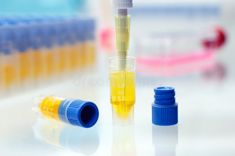 PCR samples in microtubes stock photo. Image of blue - 40676854