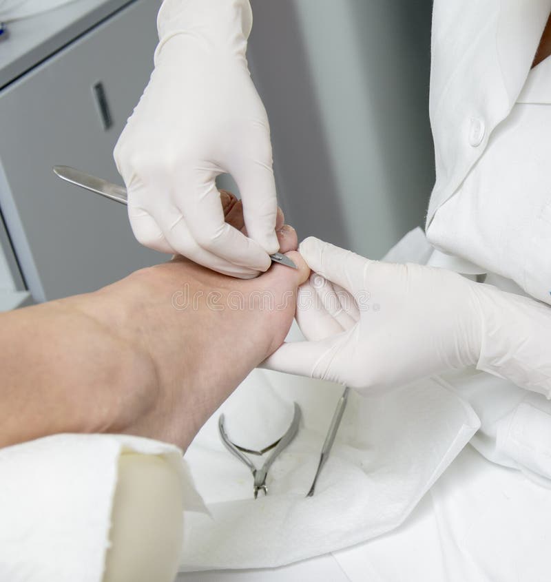 Pedicure treatment stock image. Image of barefoot, doctor - 40132917