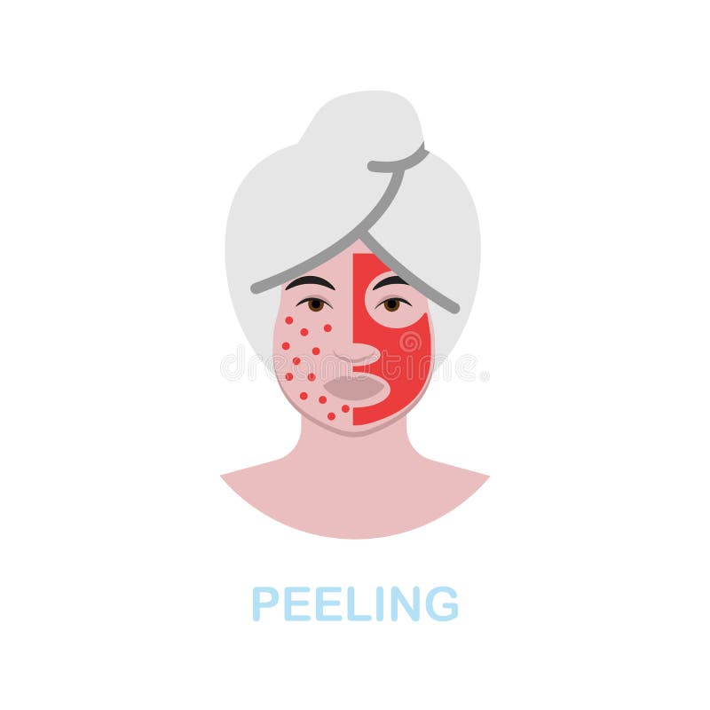 Peeling Flat Icon. Colored Element Sign from Cosmetology Collection ...