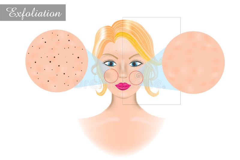 Exfoliation. cosmetology stock vector. Illustration of female - 66373215