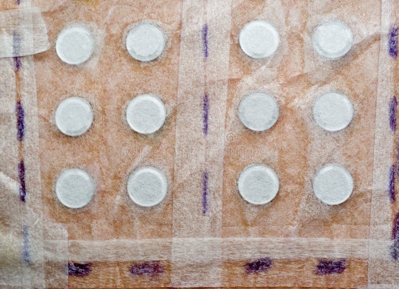 Prueba De Alergia Parches Fotos de stock - Fotos libres de regalías de ...