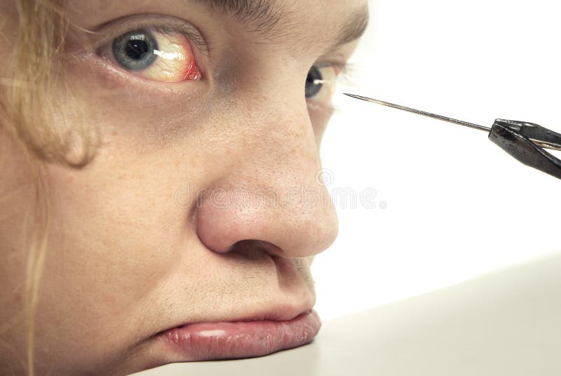 Hombre con el ojo morado imagen de archivo. Imagen de cierre - 9823109