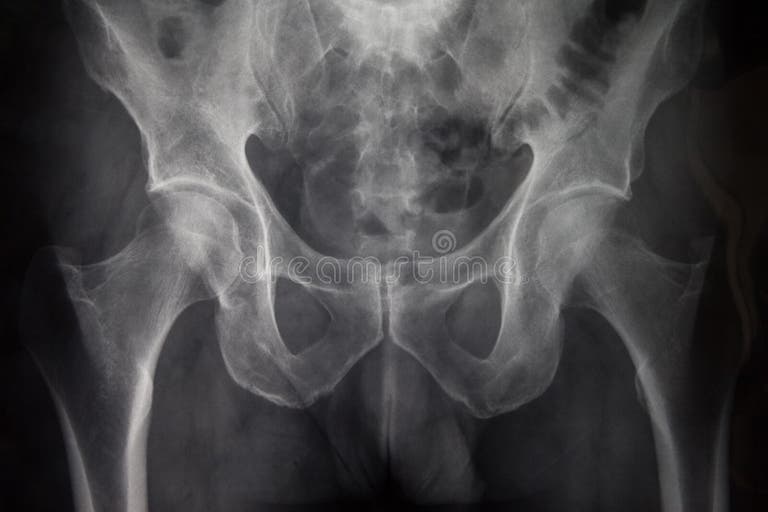 330 Female Pelvic Exam Stock Photos - Free & Royalty-Free Stock Photos ...