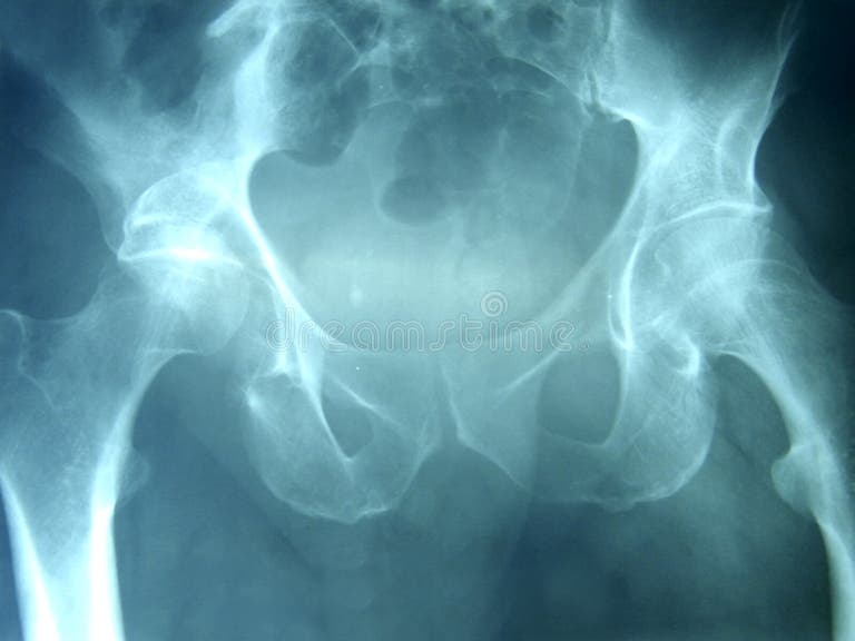 1,809 Radiographic Diagnosis Iopar Stock Photos - Free & Royalty-Free ...