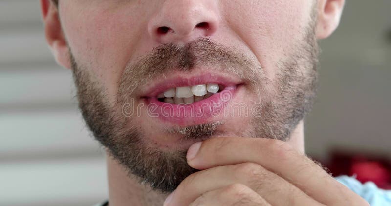 Pensive Confused Guy Leaning Hand, Rubbing Beard Stock Video - Video of ...