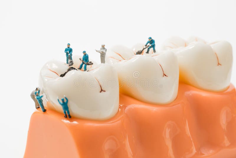 People To Clean Tooth Model ,miniature Stock Photo - Image of clinic ...