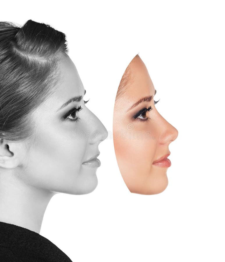 Perfect face surgery - kizacovers