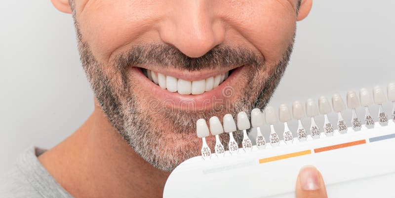 Perfect Smile, Teeth Whitening Concept Stock Image - Image of tooth ...