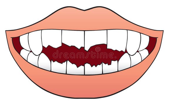 Teeth Gap Cartoon Stock Illustrations – 151 Teeth Gap Cartoon Stock ...