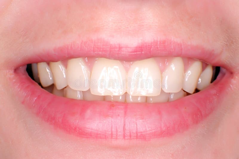 Perfect teeth stock photo. Image of fresh, macro, happiness - 2362534