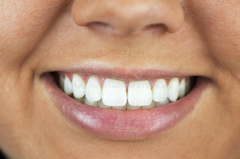 La Bouche Ouverte De La Femme, Dents Parfaites Photo stock - Image du ...