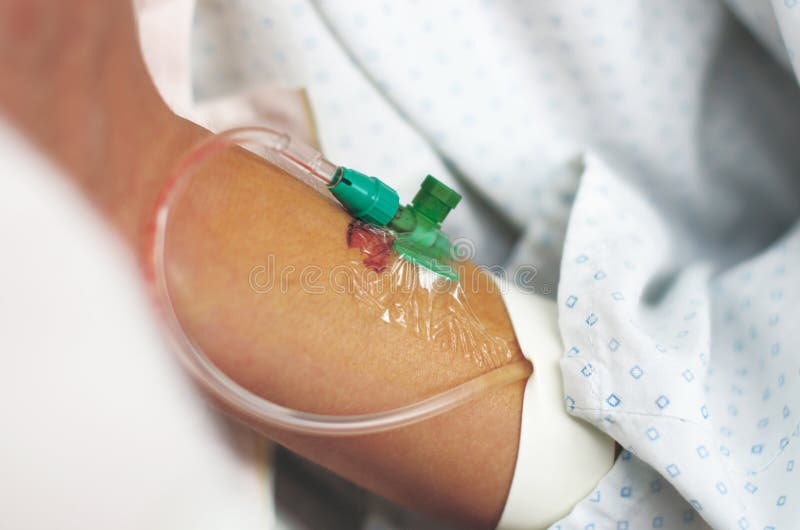 522 Perfusion Photos - Free & Royalty-Free Stock Photos from Dreamstime