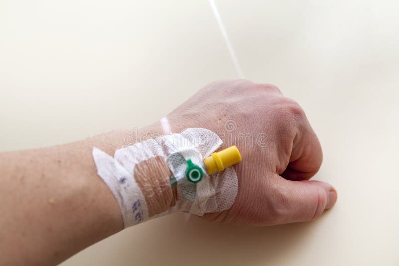Peripheral Catheter on the Patient`s Arm before Cardiac Surgery Stock ...
