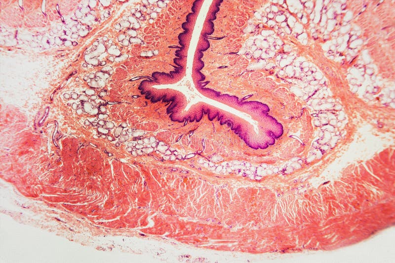 Esófago Fotos De Stock - Download 1,098 Fotos Libres de Derechos