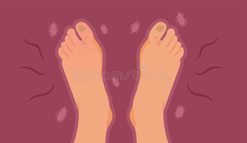 Stinky Feet Unprotected from Bacteria Problems Vector Illustration ...