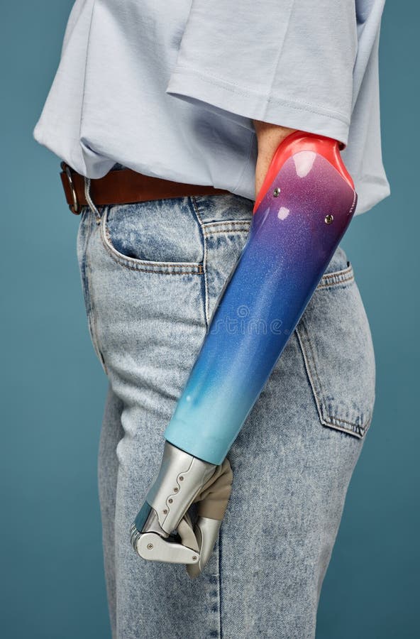 156 Myoelectric Arm Stock Photos - Free & Royalty-Free Stock Photos ...