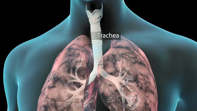 Person with damaged lungs stock illustration. Illustration of windpipe ...