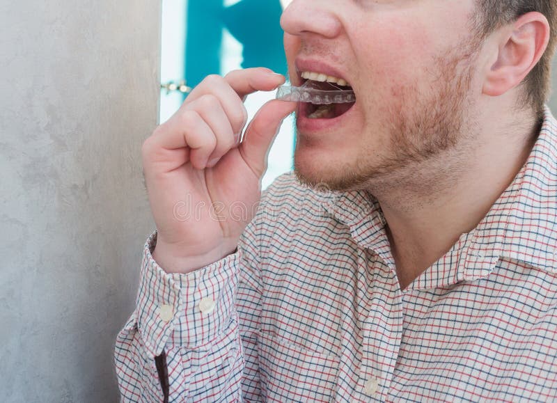 A Person Demonstrates Putting on a Plastic Aligner Plate from Brcusism ...