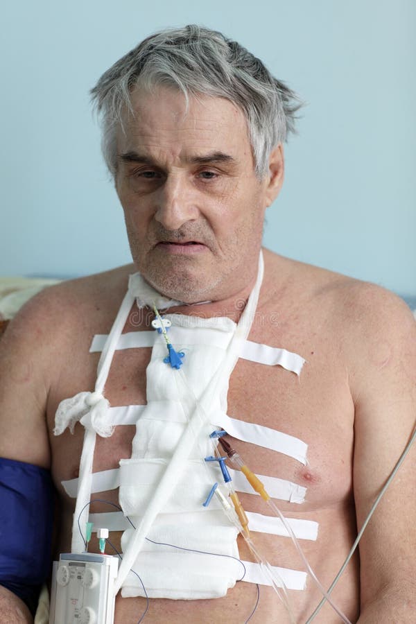 Person with pacemaker stock image. Image of operation - 29714247