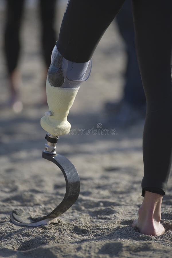 Person with prosthetic leg stock image. Image of medical - 30851559