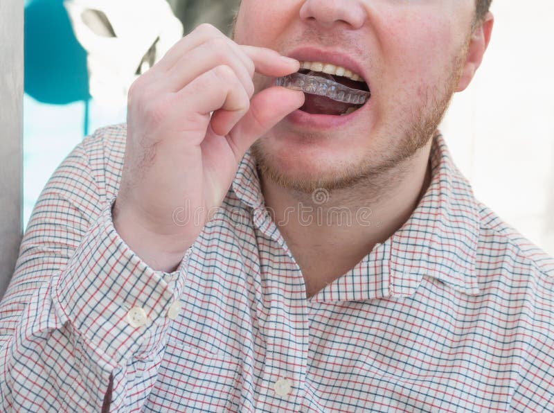 A Person Puts a Plastic Aligner Plate on His Teeth from Brcusism, a Cap ...