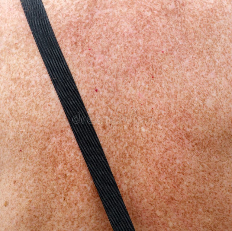 Black Woman Scar Back Stock Photos - Free & Royalty-Free Stock Photos ...