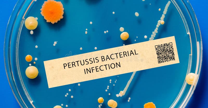 Pertussis (whooping Cough) - Bacterial Infection that Can Cause Severe ...