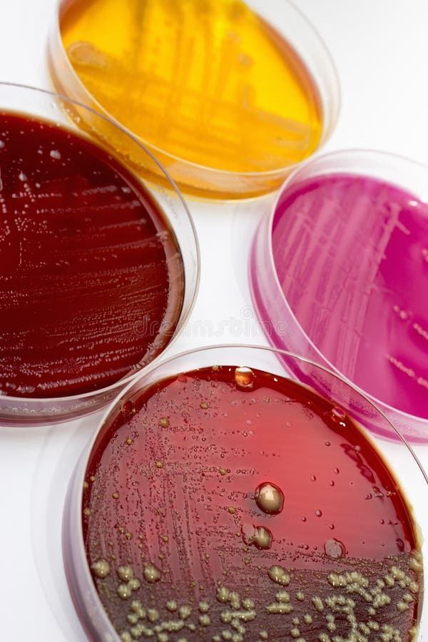 Petri dish with mold stock image. Image of microbiology - 29277065