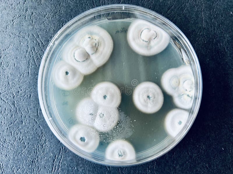 Petri Dish with White Mold in a Laboratory Setting Stock Photo - Image ...