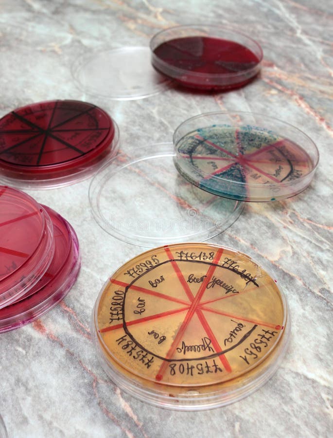 Petri Dish Specimen stock image. Image of jelly, bacterial - 15628331