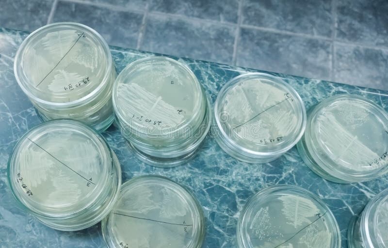 Petri Dishes Under the Microscope Stock Image - Image of legionella ...
