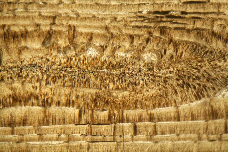 Thin Section of Nummulite Limestone Under the Microscope Stock Photo ...