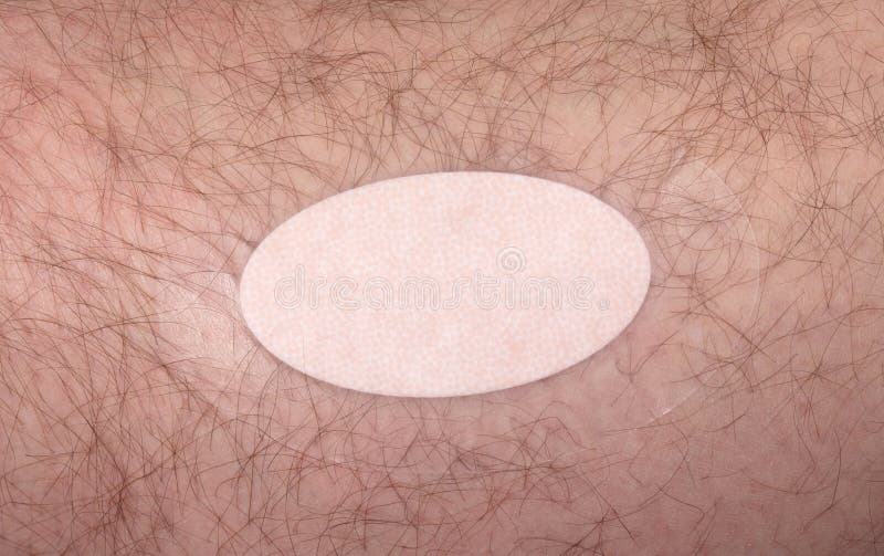 Pflaster auf der Haut stockfoto. Bild von männer, unfall - 167251968